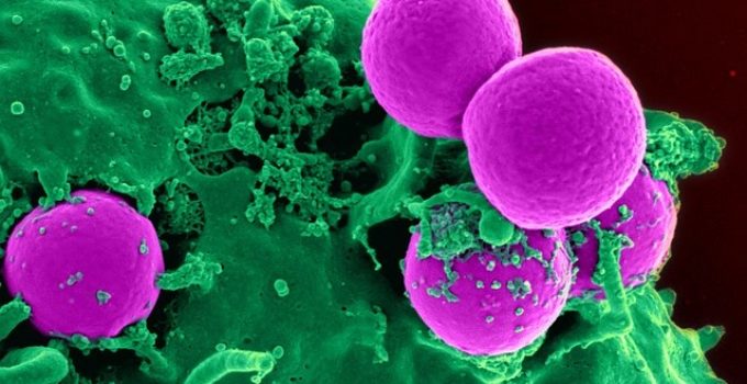 Linfociti alti e bassi (LYMPH) - Laboratorio Dr. D'Errico Angelo